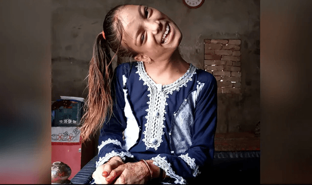 This Pakistani girl with neck bent at 90 degrees was treated ...